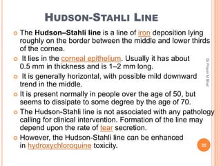 Hudson Stahli Line
