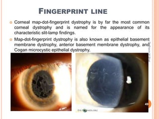 Dots spots lines and rings in ophthalmology | PPT