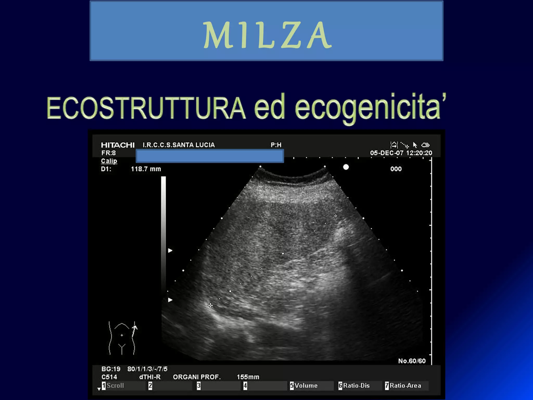 Ecografia alla milza | PPTX