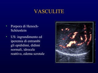 US Scroto | PPT
