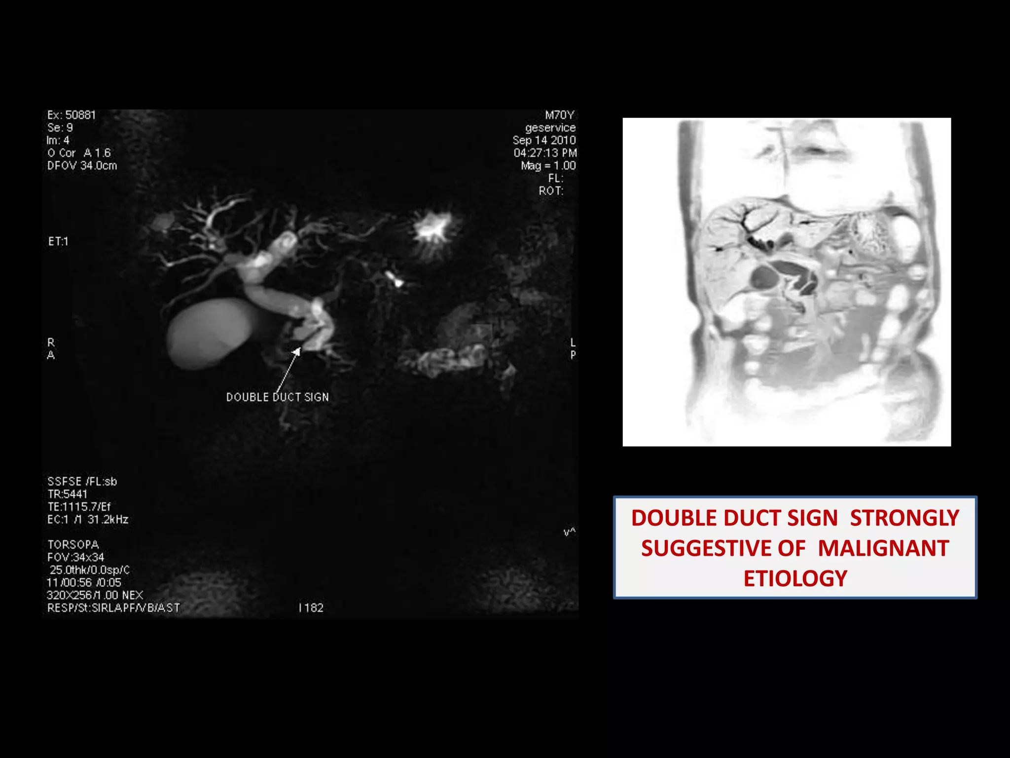 Double duct sign | PPTX