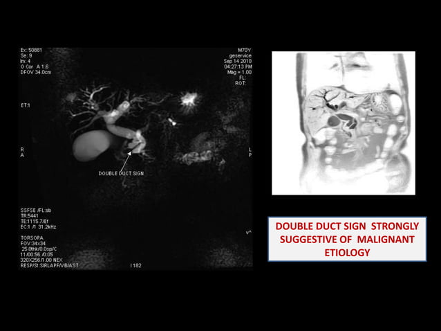 Double duct sign | PPTX