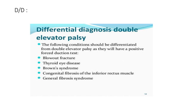Double elevator palsy | PPTX