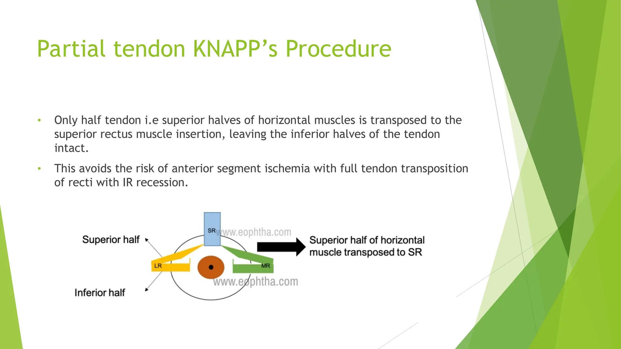 double elevator palsy with examination in | PPT