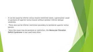 double elevator palsy with examination in | PPT