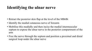 Double fascicular transfer for elbow flexion | PPTX