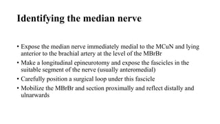 Double fascicular transfer for elbow flexion | PPTX
