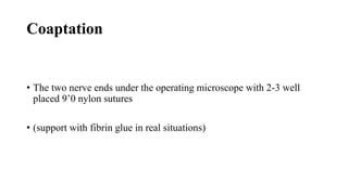 Double fascicular transfer for elbow flexion | PPTX
