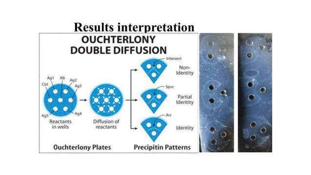 DOUBLE IMMUNODIFFUSION METHO(mancini method)D.pptx