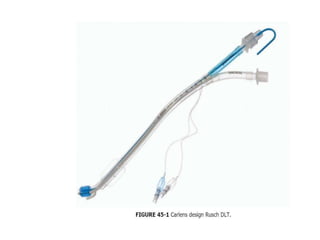 Double lumen tubes | PPTX