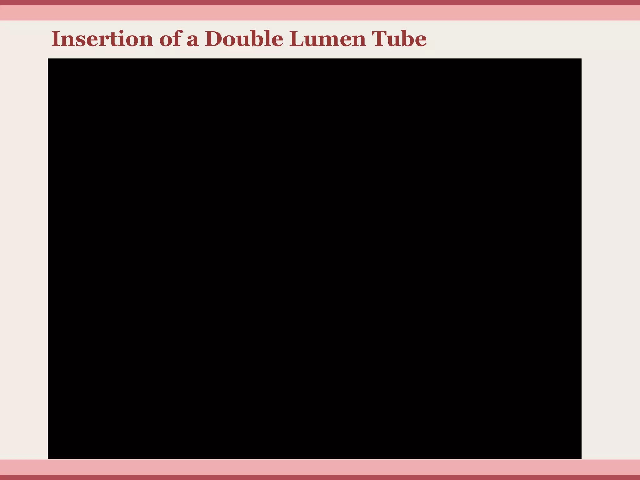 Double lung ventilation | PPT