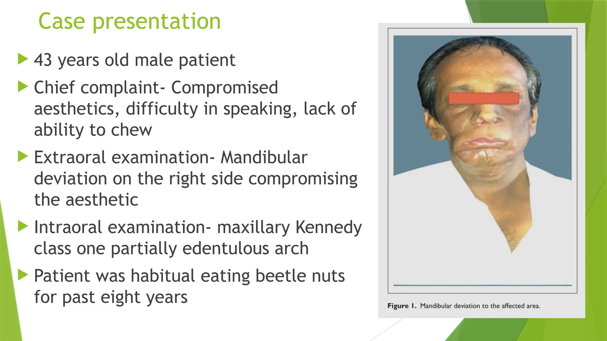 double occlusal prosthesis - JC.pptx presentation | PPTX