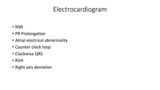 Double outlet right ventricle | PPTX