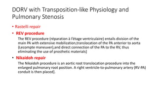 Double outlet right ventricle | PPTX