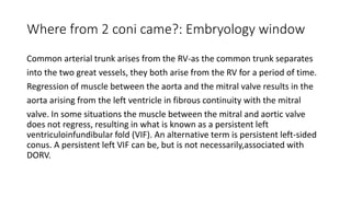 Double outlet right ventricle | PPTX