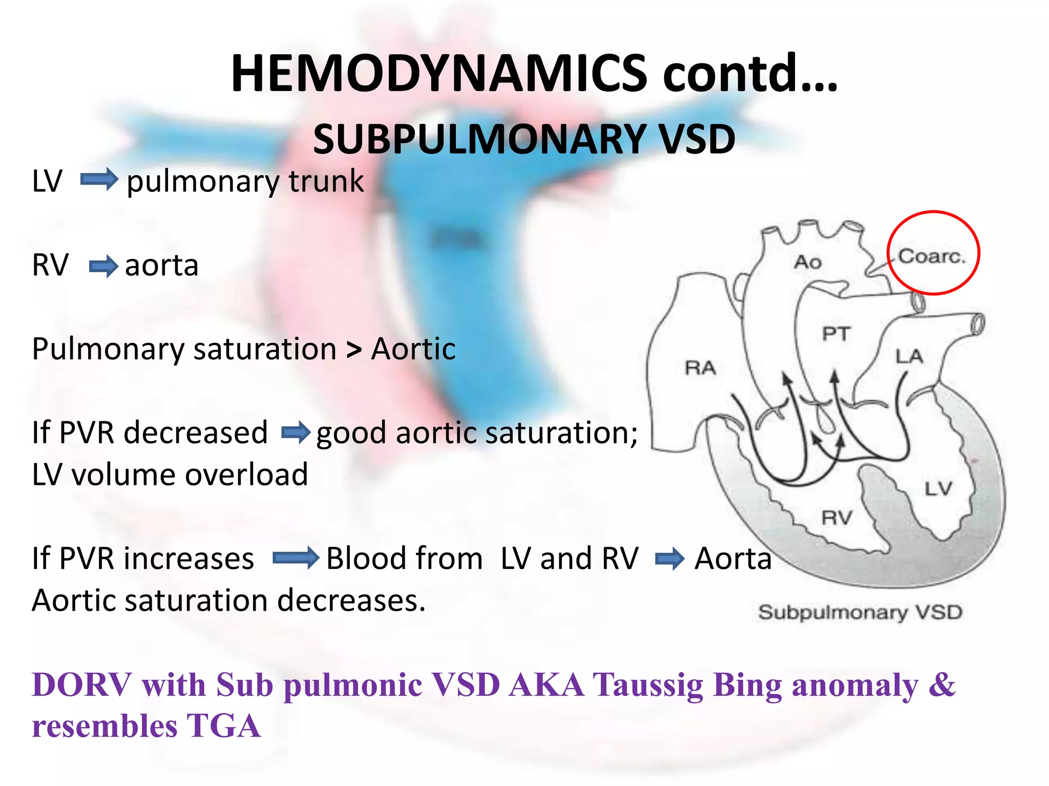 Double outlet right ventricle | PPTX