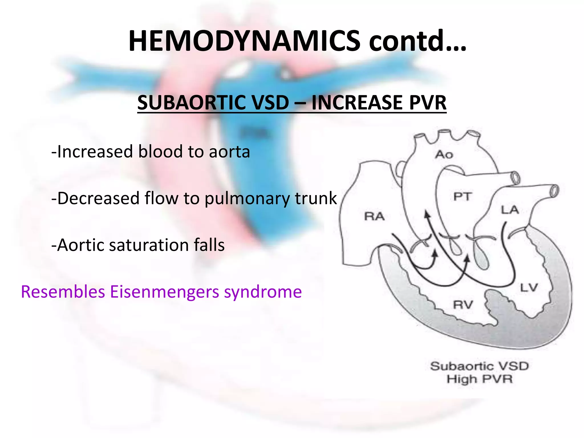 Double outlet right ventricle | PPTX