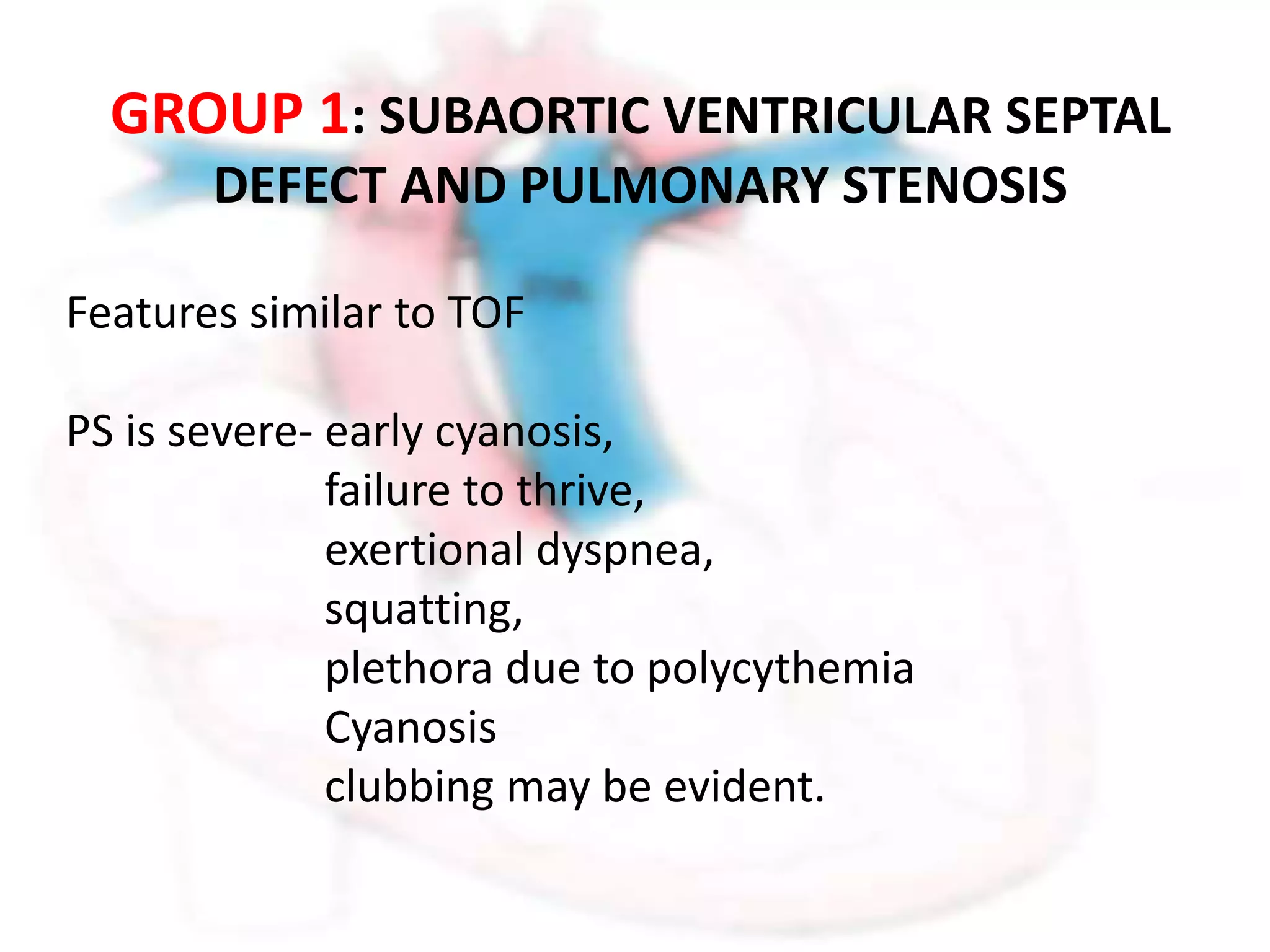 Double outlet right ventricle | PPTX