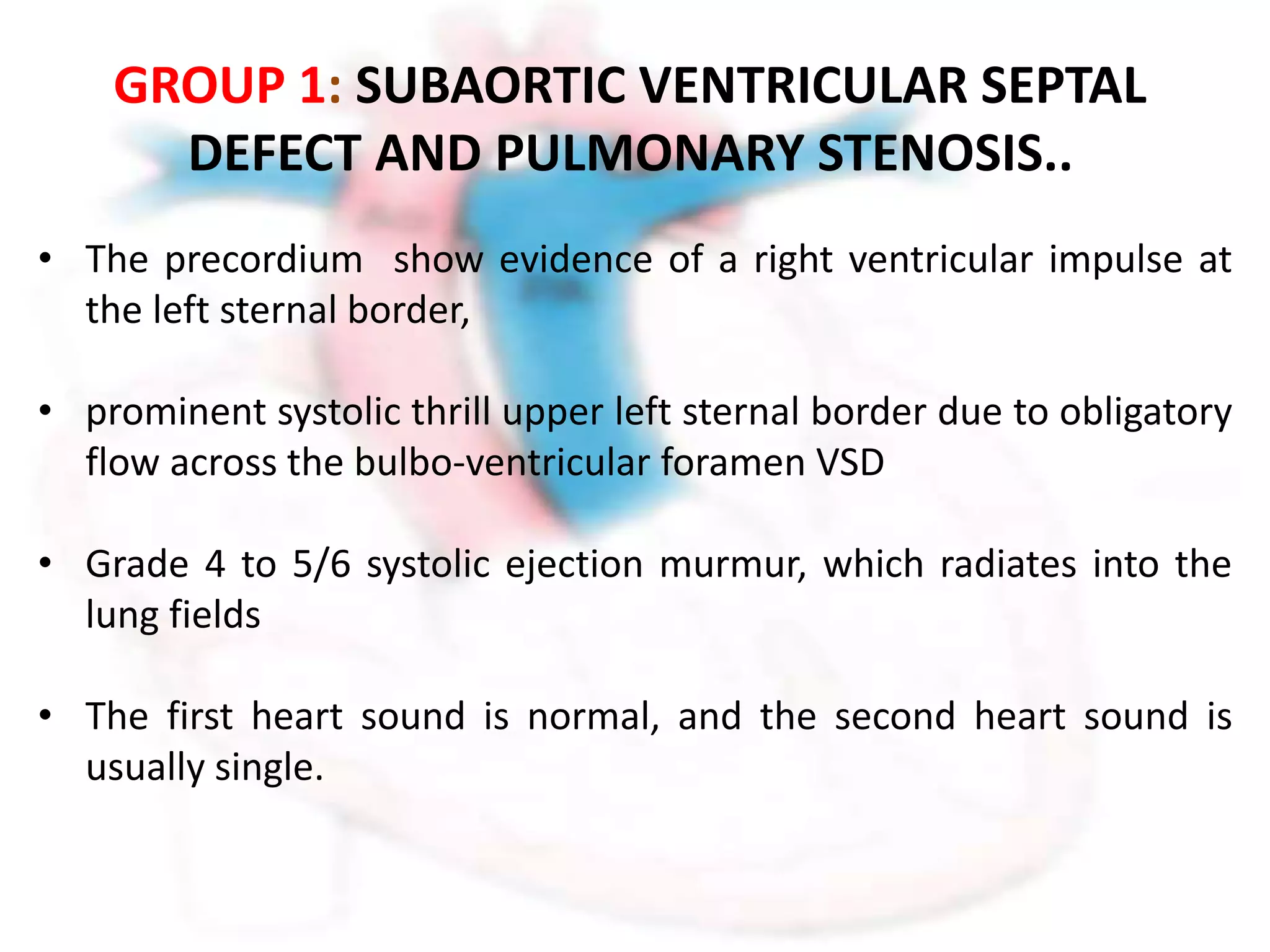 Double outlet right ventricle | PPTX