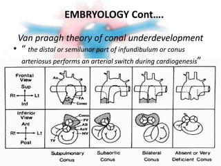 Double outlet right ventricle | PPTX