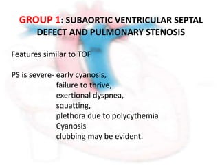 Double outlet right ventricle | PPTX