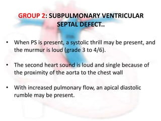 Double outlet right ventricle | PPTX