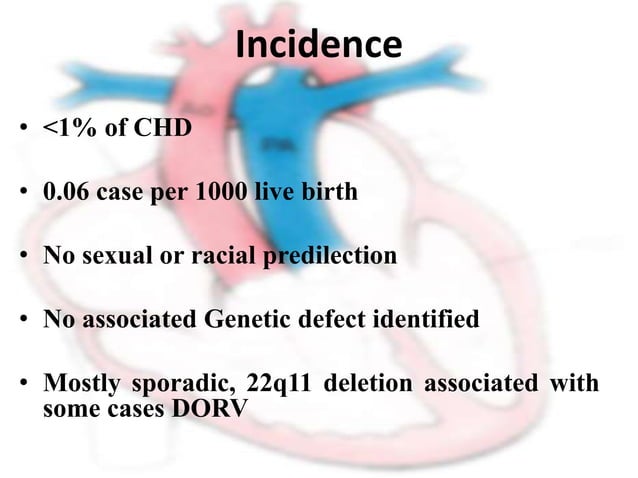 Double outlet right ventricle | PPTX