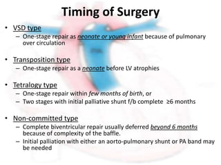 Double outlet right ventricle | PPTX