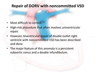 Double outlet right ventricle | PPTX