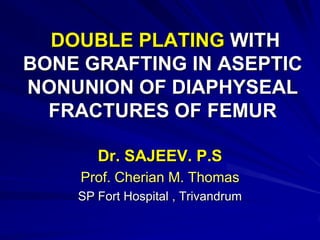 Double plating nonunion femur | PPT | Death, Injury, or Military ...