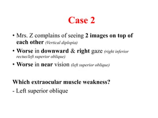 Diplopia- Double vision | PPTX