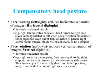 Diplopia- Double vision | PPT