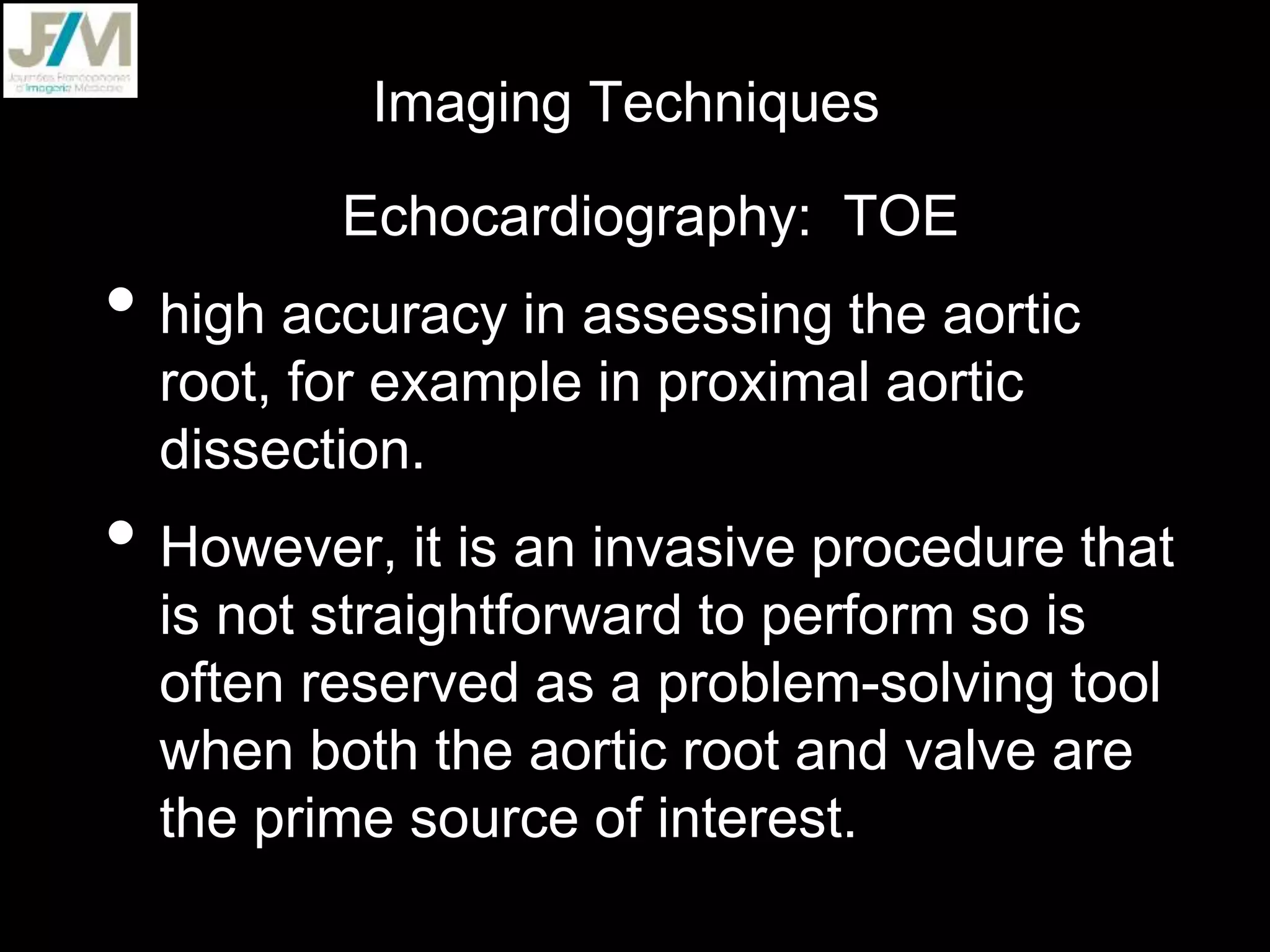 Acute Aortic Syndromes: Vascular Radiologist Point of View - Pr Ph ...