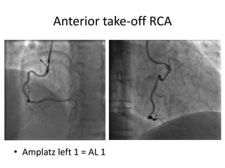 High Class Interventions | PDF
