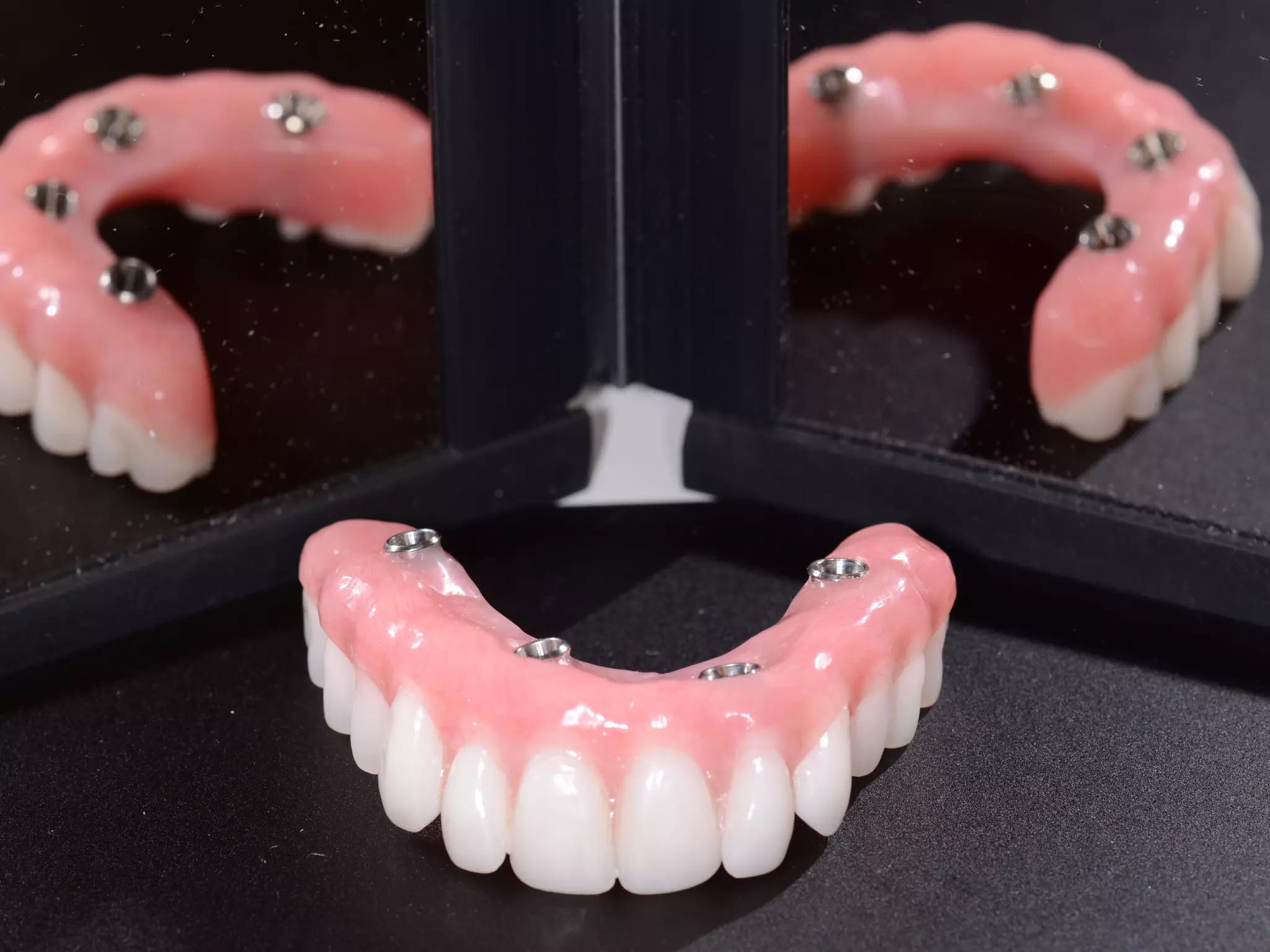 Prosthodontist's Tips for Full Arch Fixed Hybrid | PDF