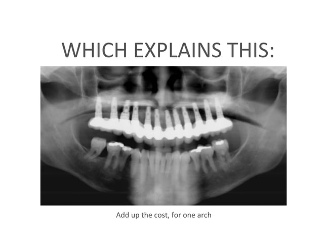 Prosthodontist's Tips for Full Arch Fixed Hybrid | PDF | Dental Health ...