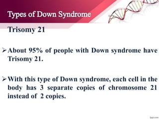 Down syndrome | PPTX