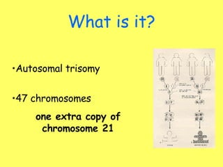 Down Syndrome Child | PPT | Genetics | Science