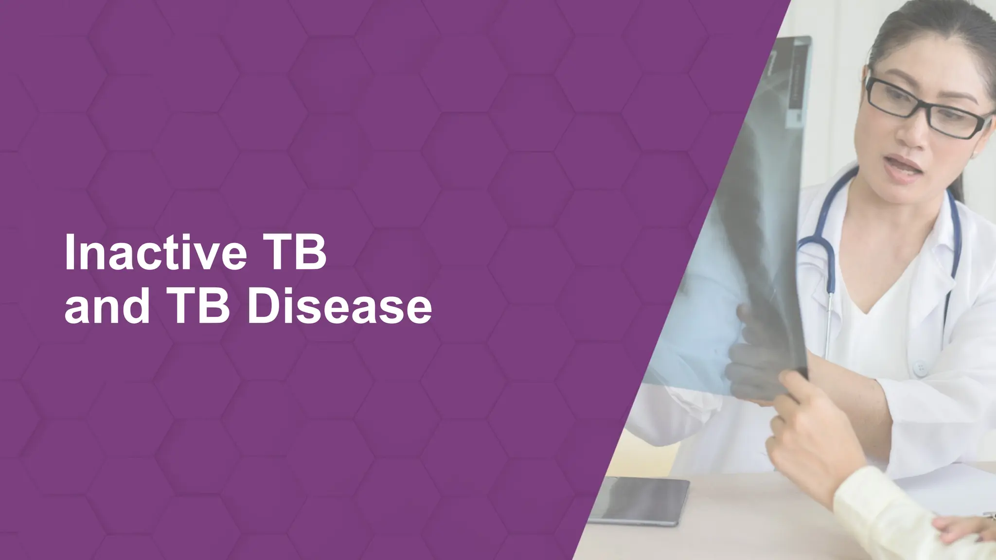 TUBERCULOSIS AND ITS TYPES AND MANAGEMENT | PPTX