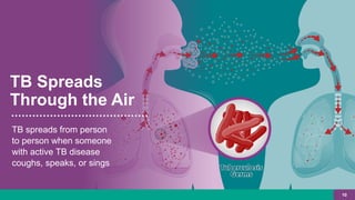 TUBERCULOSIS AND ITS TYPES AND MANAGEMENT | PPTX | Infectious Diseases ...