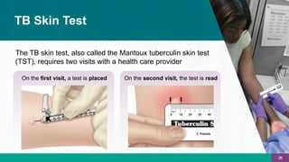 TUBERCULOSIS AND ITS TYPES AND MANAGEMENT | PPTX