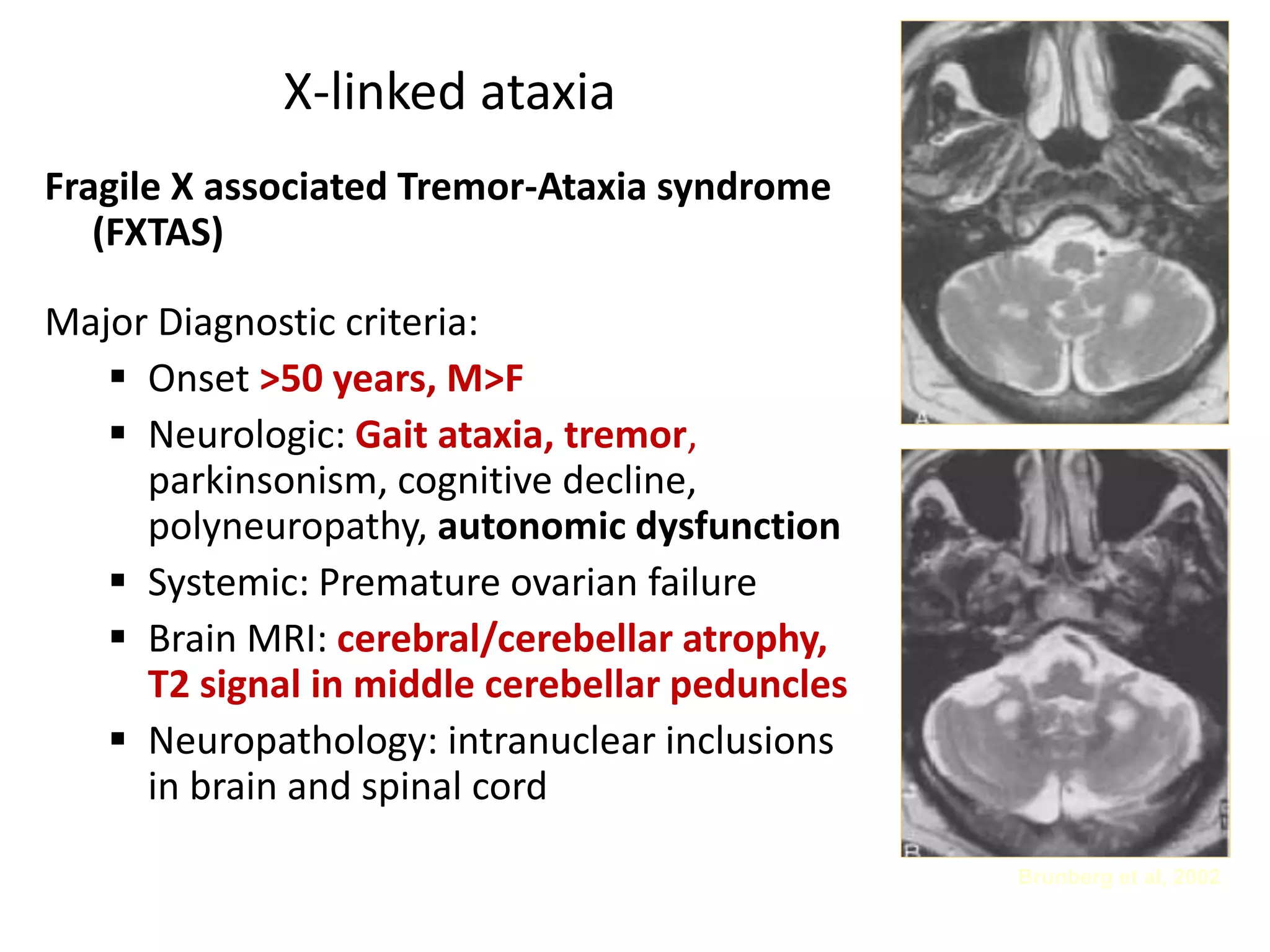 Approach to ataxia | PPTX | Physical Therapy | Wellness