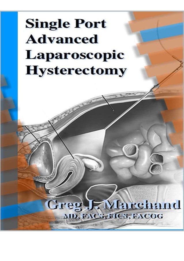 Download Pdf Single Port Advanced Laparoscopic Hysterectomy An Advanced Ultra Minimally Invasive