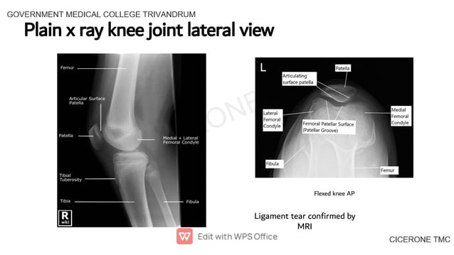 Radiology anatomy first year images xrays | PDF | Death, Injury, or Military Conflict ...