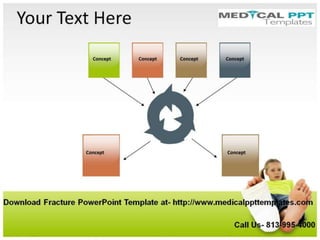 Fracture PowerPoint Template | PPT