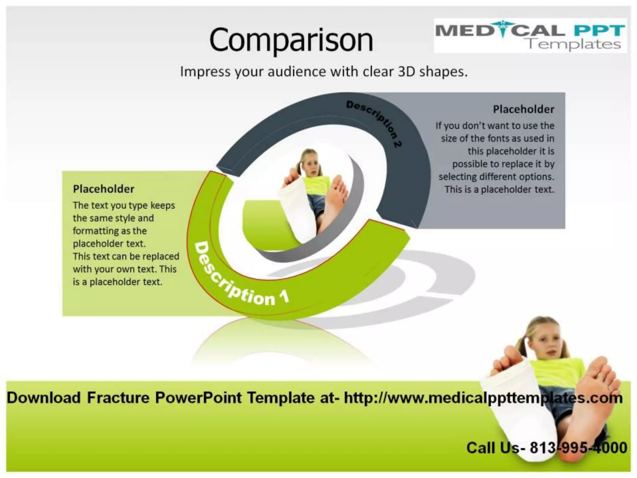 Fracture PowerPoint Template- Medical PPT Templates | PPTX