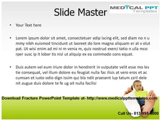 Fracture PowerPoint Template- Medical PPT Templates | PPTX