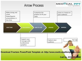Fracture PowerPoint Template- Medical PPT Templates | PPTX