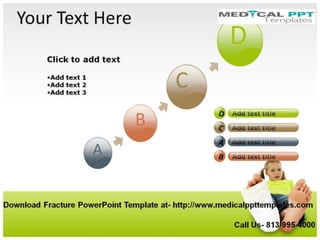 Fracture PowerPoint Template- Medical PPT Templates | PPTX