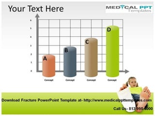 Fracture PowerPoint Template- Medical PPT Templates | PPT